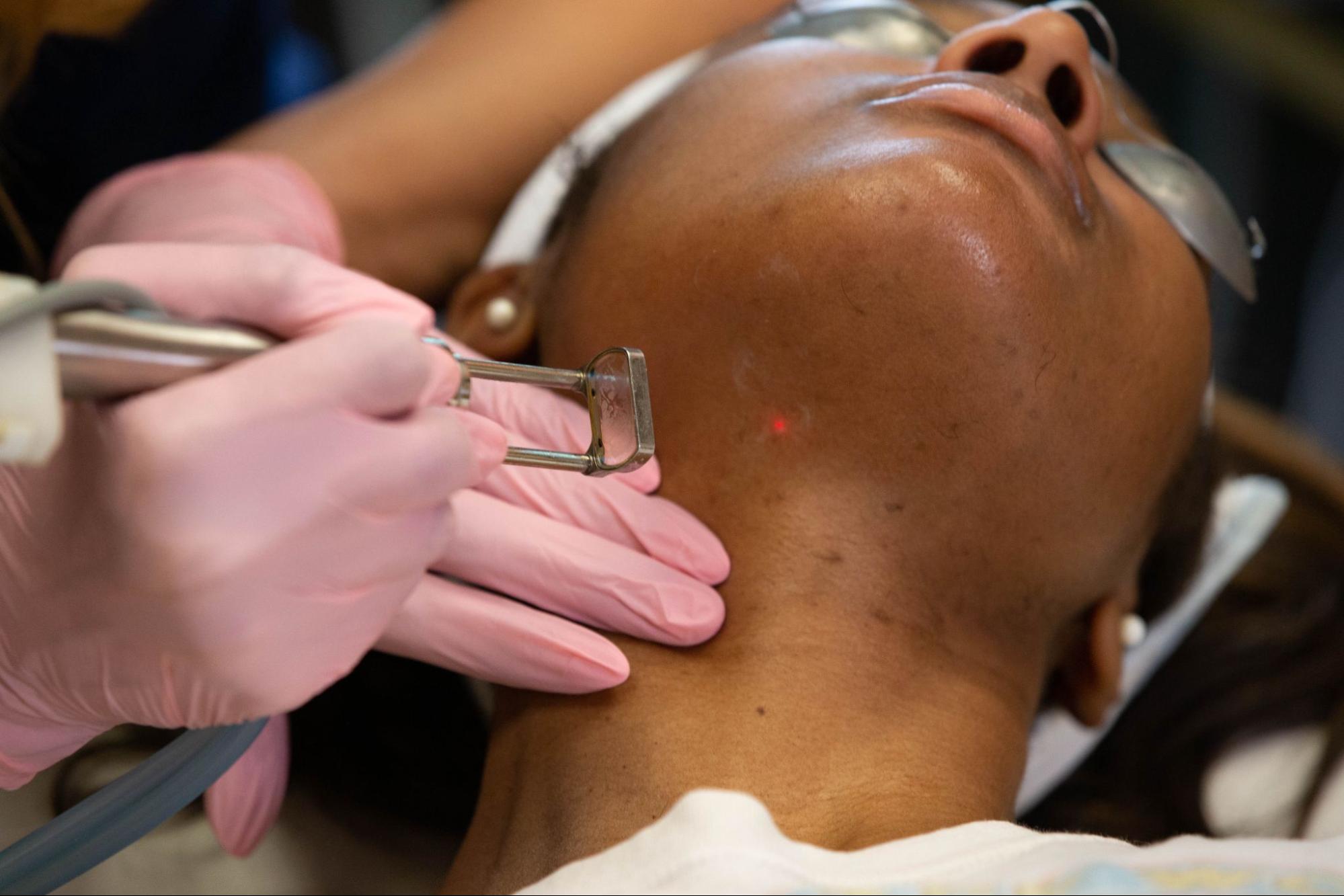 How Lasers Help Revitalize Your Skin | Dermatology Realm